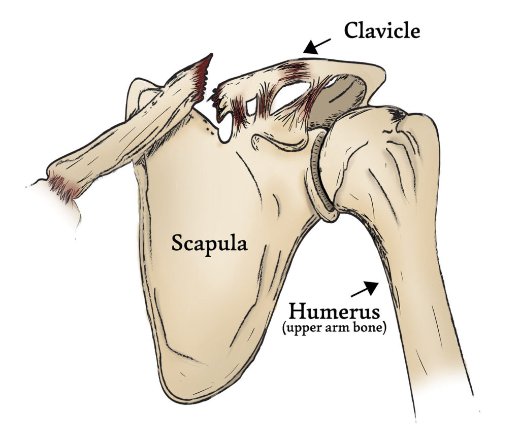 Child arm sling AM‑SOB‑03 | 4Kids - Ortezy dla dzieci