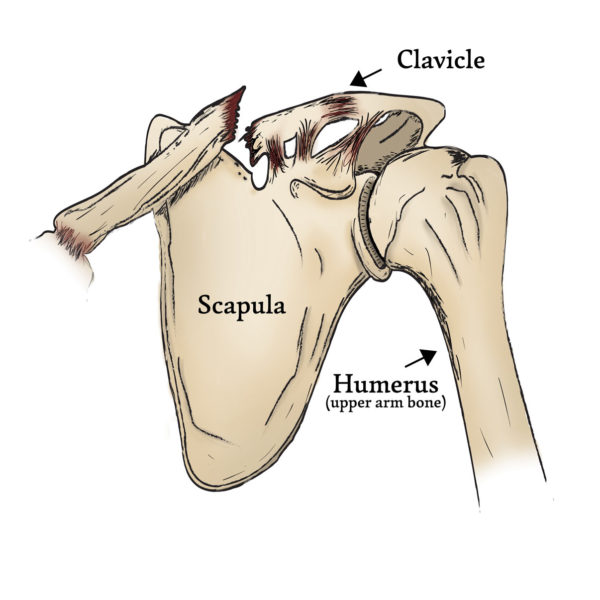 Kids clavicle fracture figure-8 brace AM‑PES‑02 | 4Kids - Ortezy dla dzieci